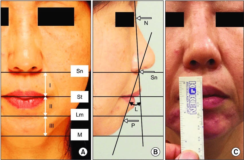 The Chin Copy - Enhance Me Training Academy