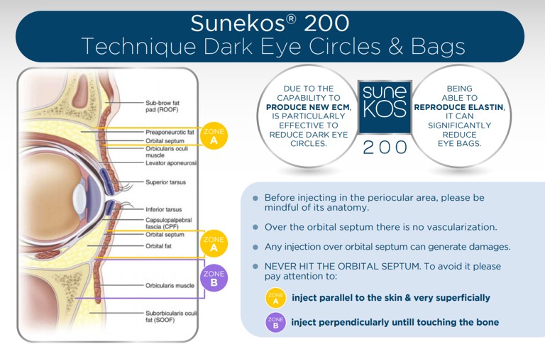 Sunekos® eye treatment - Enhance Me Training Academy