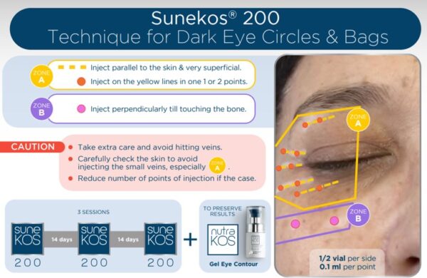 Sunekos® eye treatment - Enhance Me Training Academy