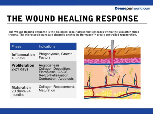 Wound healing theory - Enhance Me Training Academy